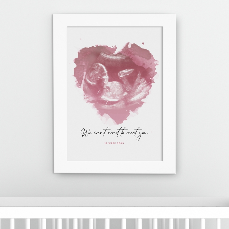 Personalised Baby Scan Print | Find Me A Gift